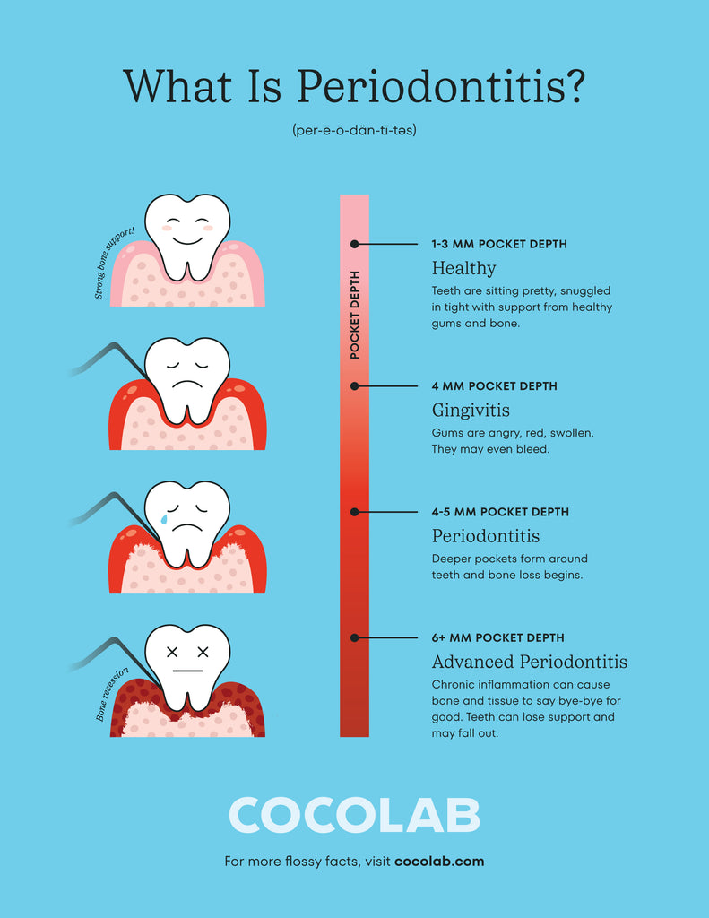 Periodontitis Print-Out – COCOLAB PRO